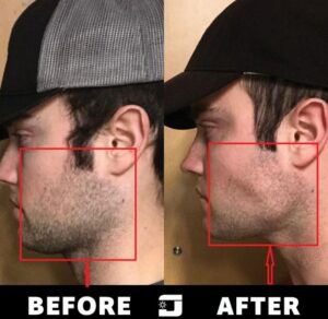 The 5 Best Jawline Exercisers Plus Jaw Exercise Guide