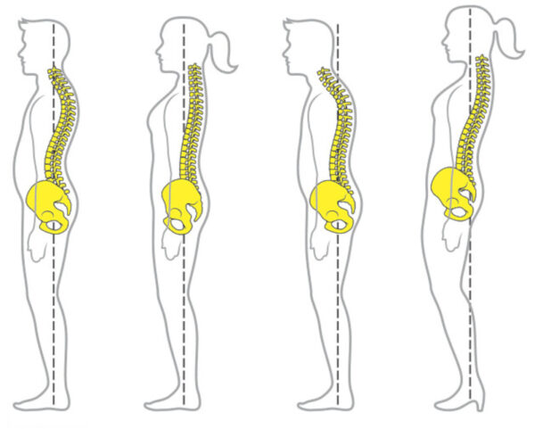 11 Best Posture Correctors for Men & Women with Buying Guide